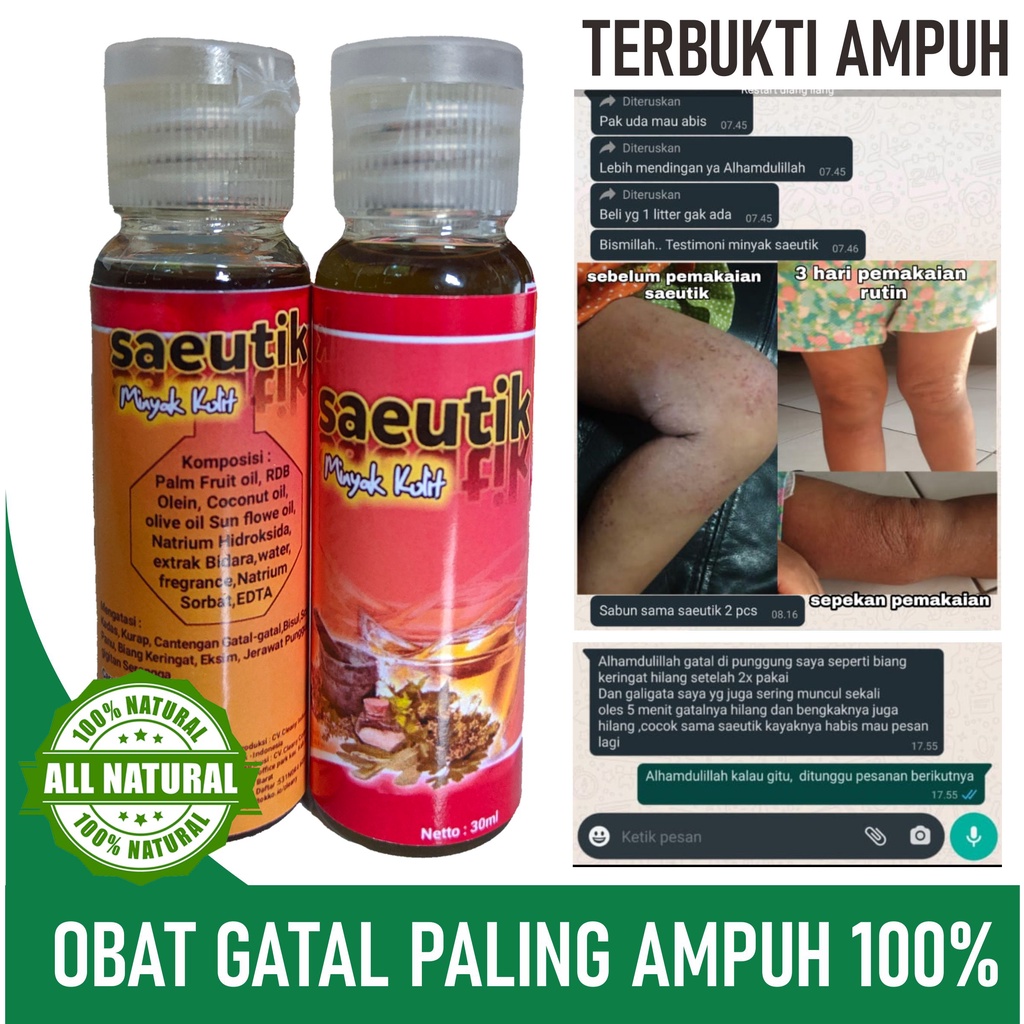 Oil ointment for itching, groin fungus, eczema, acne, tinea versicolor ...