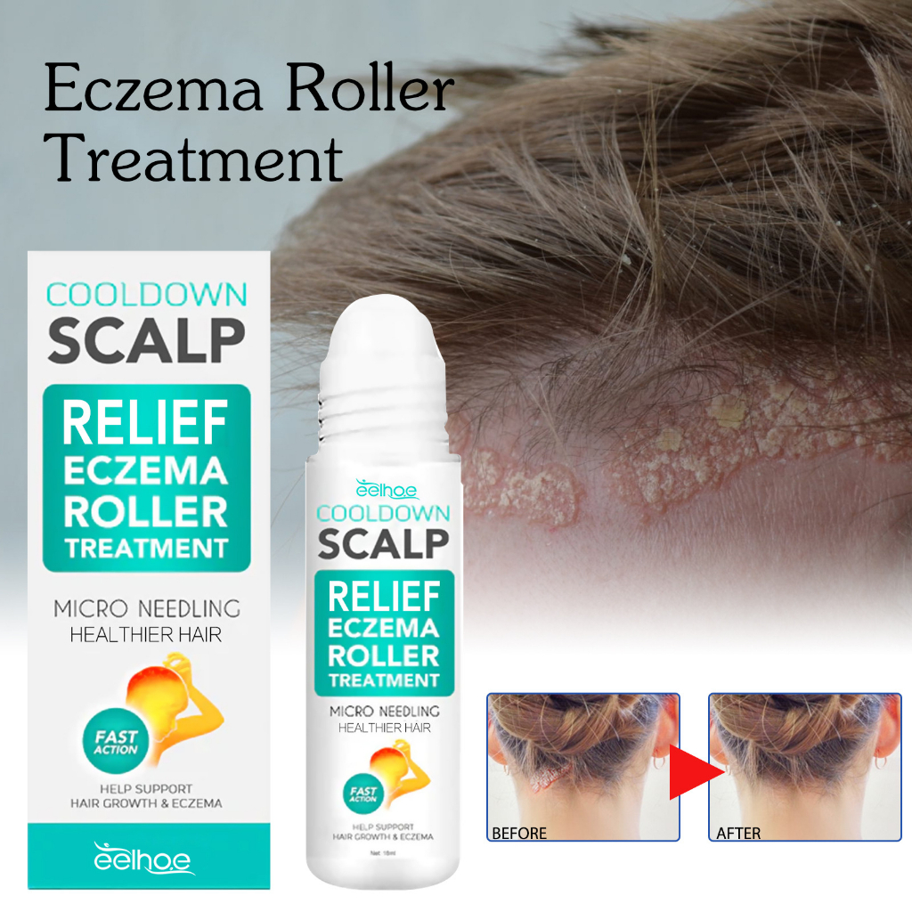 Scalp Relief Boller Serum,Scalp Moss Deep Cleaning Scalp Relief Serum ...