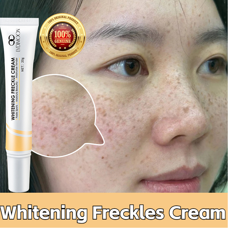 Whitening freckle cream 20g Remove age spots pigmentation Brighten Skin ...