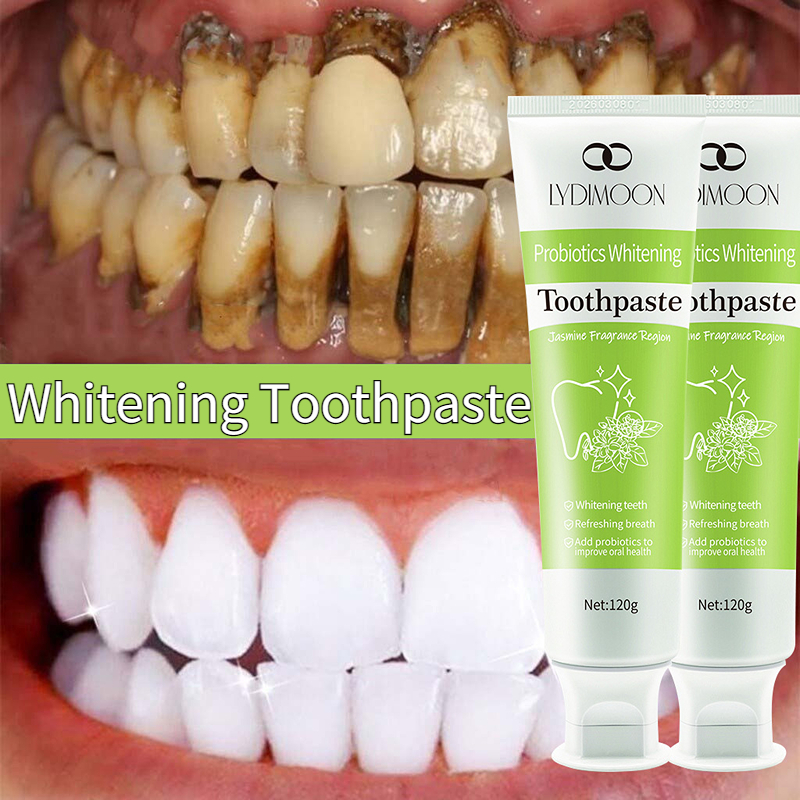 Whitening toothpaste Teeth Whitening 120g Probiotic Toothpaste Fresh Breath Remove Tooth Stains ...