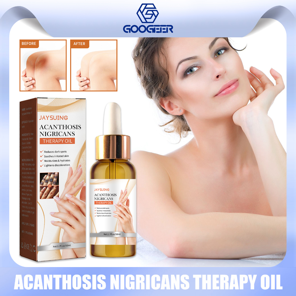 Jaysuing Acanthosis Nigricans Therapy Oil Joint De-Blackening Lighten ... Jaysuing Acanthosis Nigricans Therapy Oil Joint De-Blackening Lighten ...