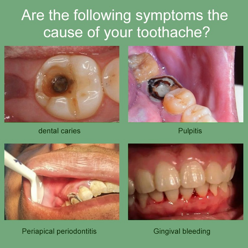 Toothache pain relief Tooth pain Spray 30ml Instant Effective Relief ...