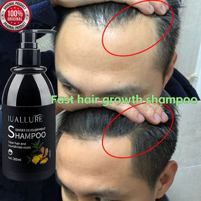 Ginger Hair Growth Shampoo 200ml Anti Hair Loss Promote Thick Hair ...