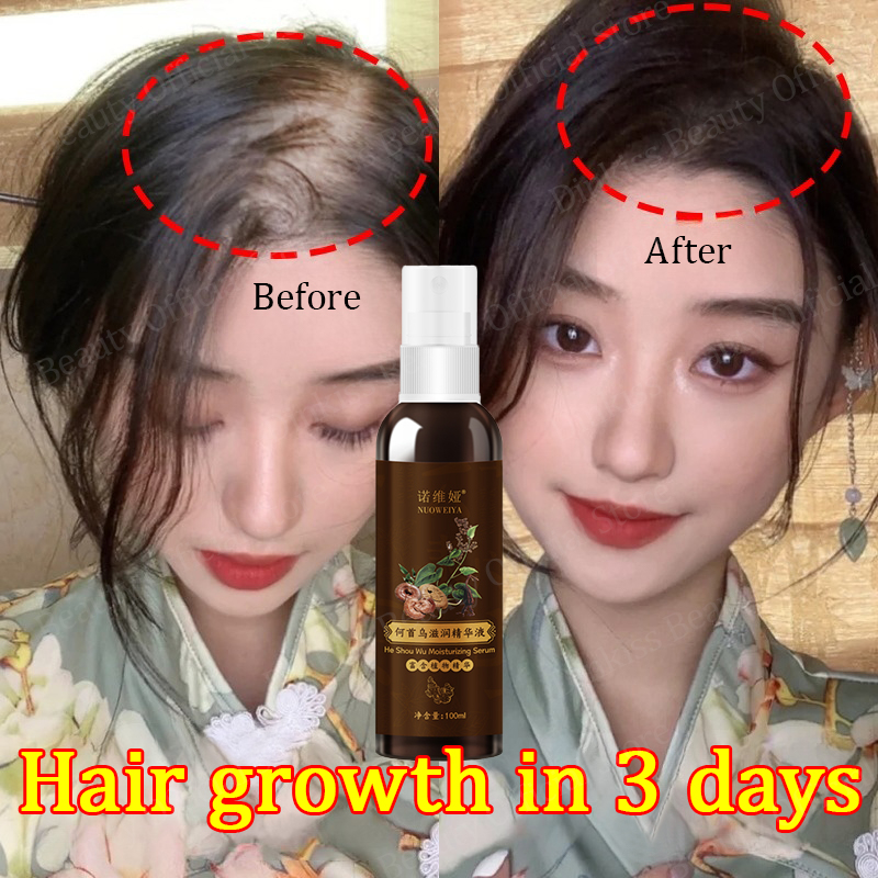 [fast Effective] Hair Growth Tonic Serum For Grow Hair Anti Hair Loss
