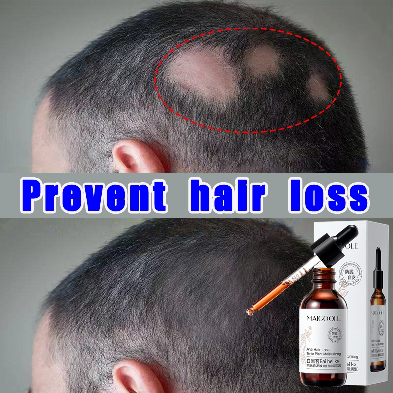 【Official genuine】MAIGOOLE Hair Growth Essence: Anti-Hair Loss, Promote ...