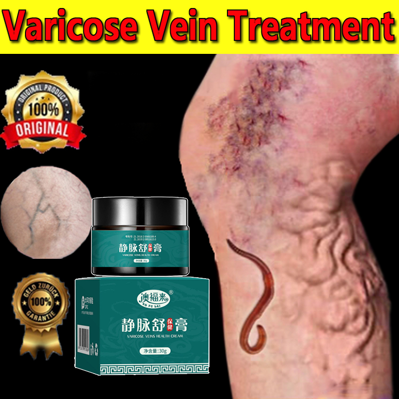 Varicose Vein Cream 30g removal varicose veins treatment Anti Foot Leg ...