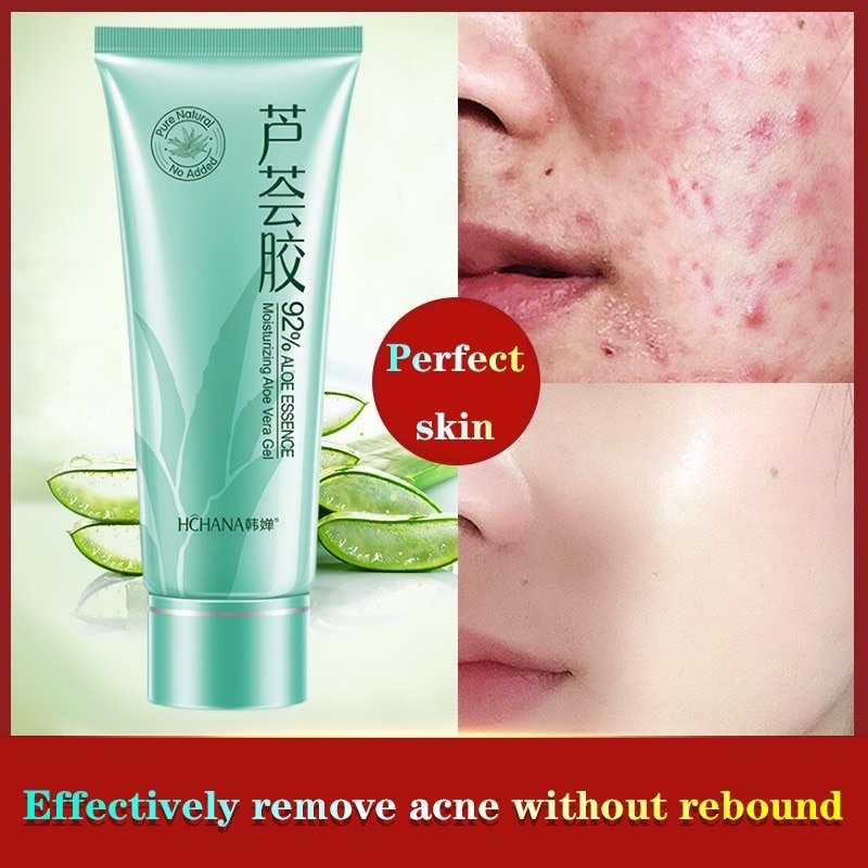 Aloe Vera Gel Acne Cream Moisturizing Anti-Inflammation Post-sun Repair ...