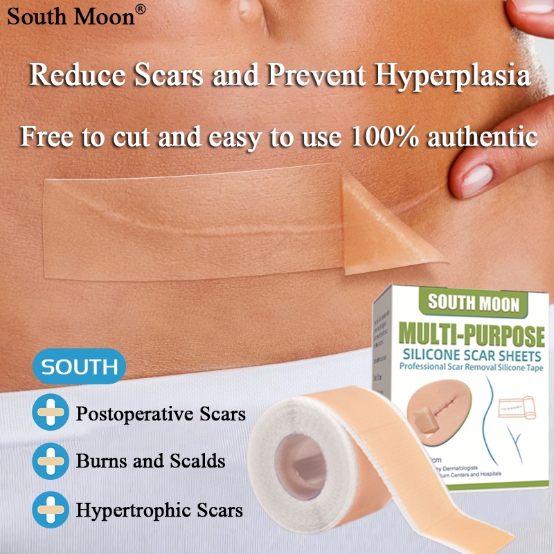 【Authenticity guaranteed】South Moon Silicone Scar Sheets, 4cmx150cm ...