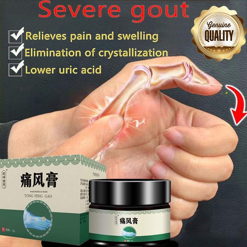 Chinese Herbal Medicine Gout Ointment Gout Cream ubat gout 35g ...