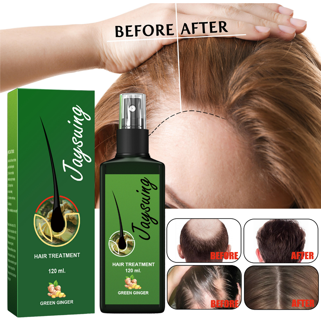 120ml Jaysuing Green Ginger Hair Growth Spray Serum Natural Anti Hair ...