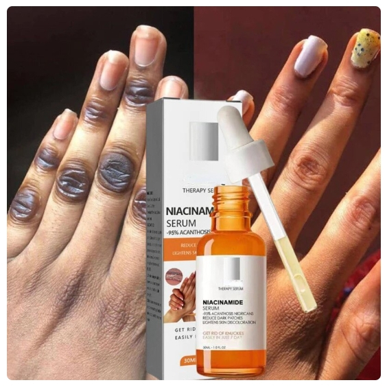 Dark Knuckles Fast Whitening Serum Pigmentation Correctors for Black ...