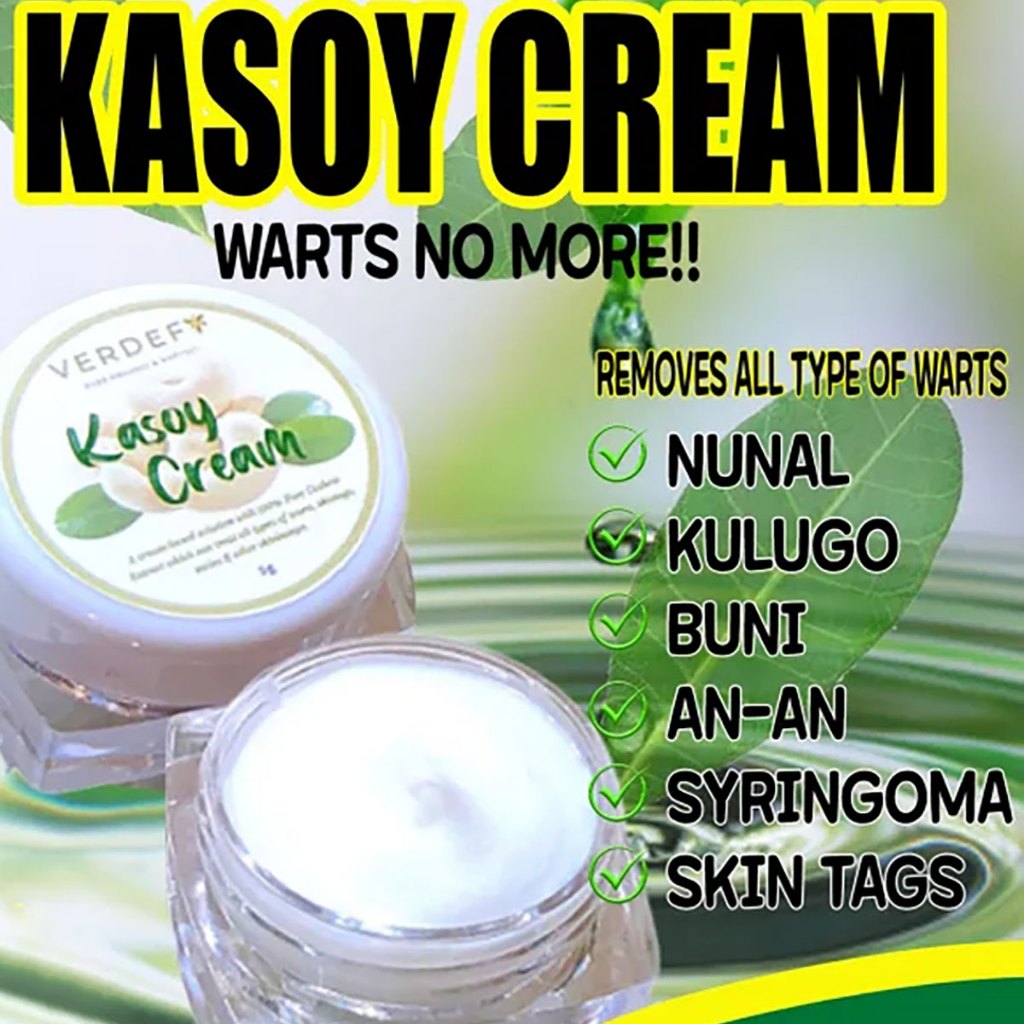 Original Cream Kasoy Oil Removal Warts and Skin Tags Painless Cashew ...