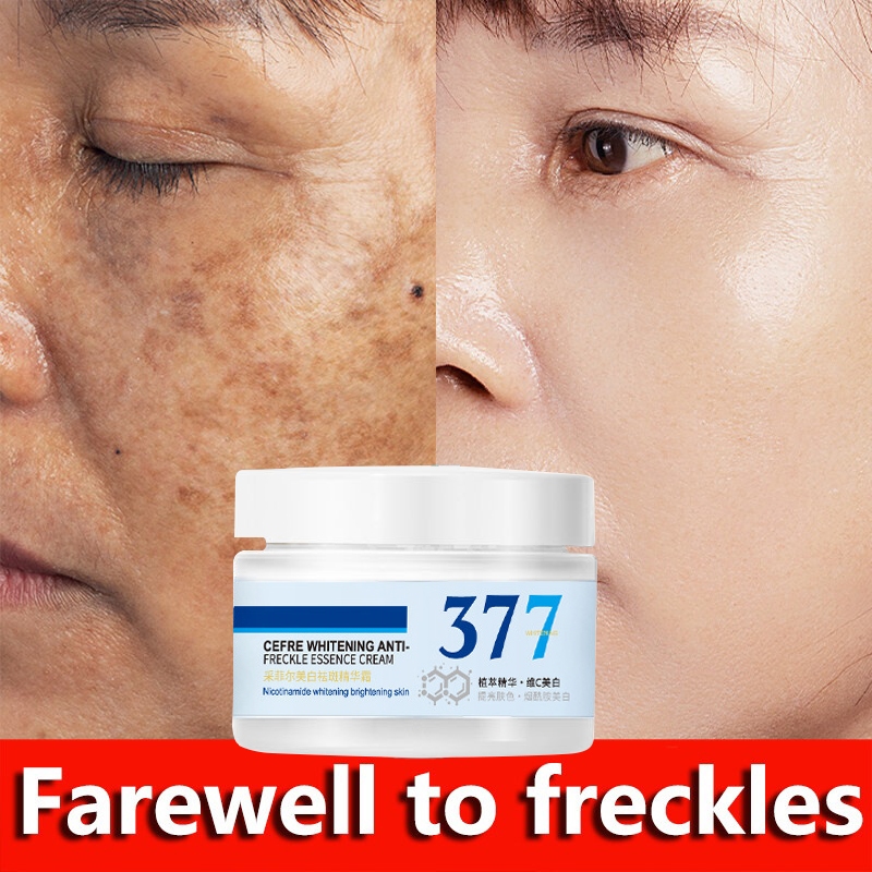 Dark Spot Remover Face Whitening Cream Freckles Removal Cream 50g ...