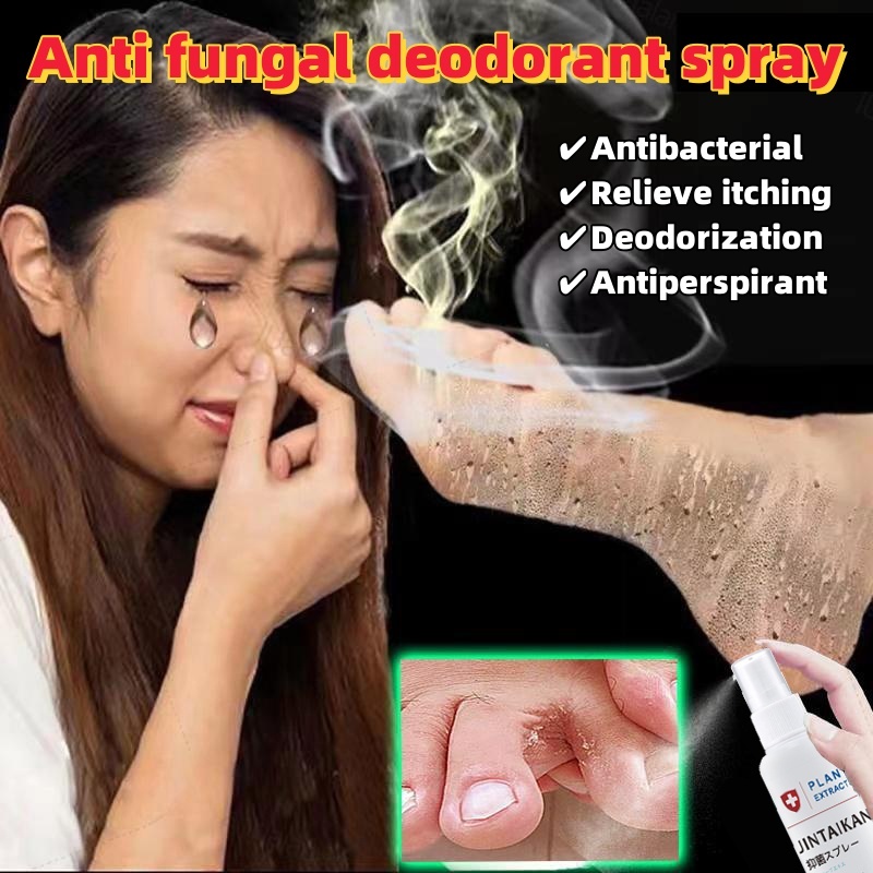 Foot deodorant spray-Footlogix anti fungal spray-Armpit deodorant ...