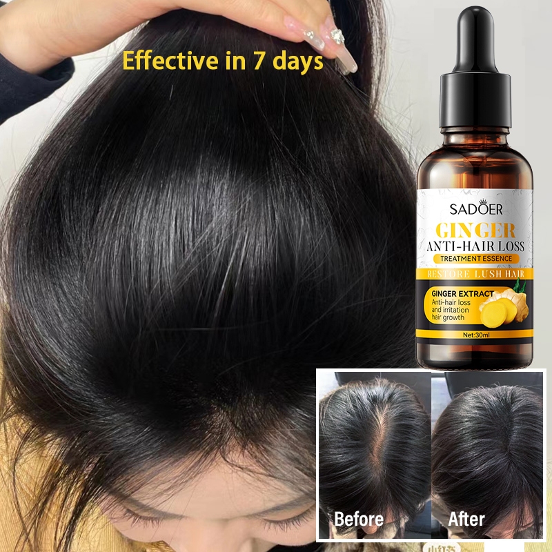 SADOER Ginger Anti-Hair Loss Serum Hair Growth/Hair Thickening Rapid ...