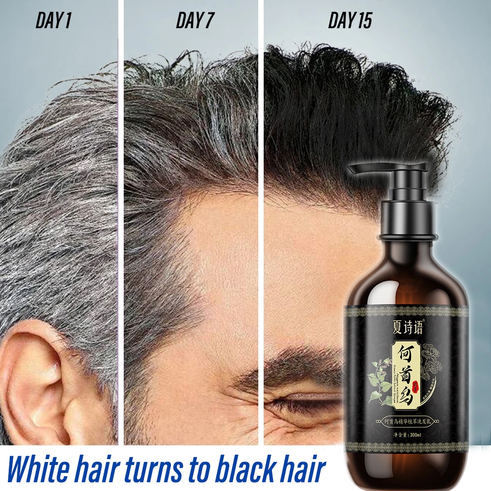 Polygonum multiflorum shampoo 300ml white hair turns black naturally ...