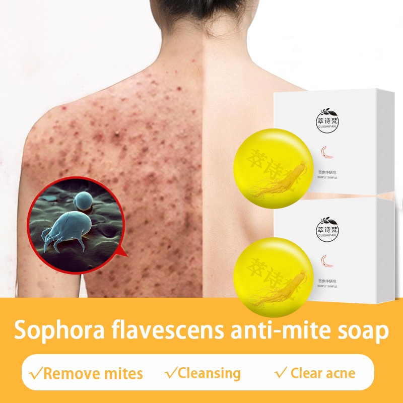 Ginseng Natural Soap Acne Soap Acne Treatment Remove Body and face Acne ...