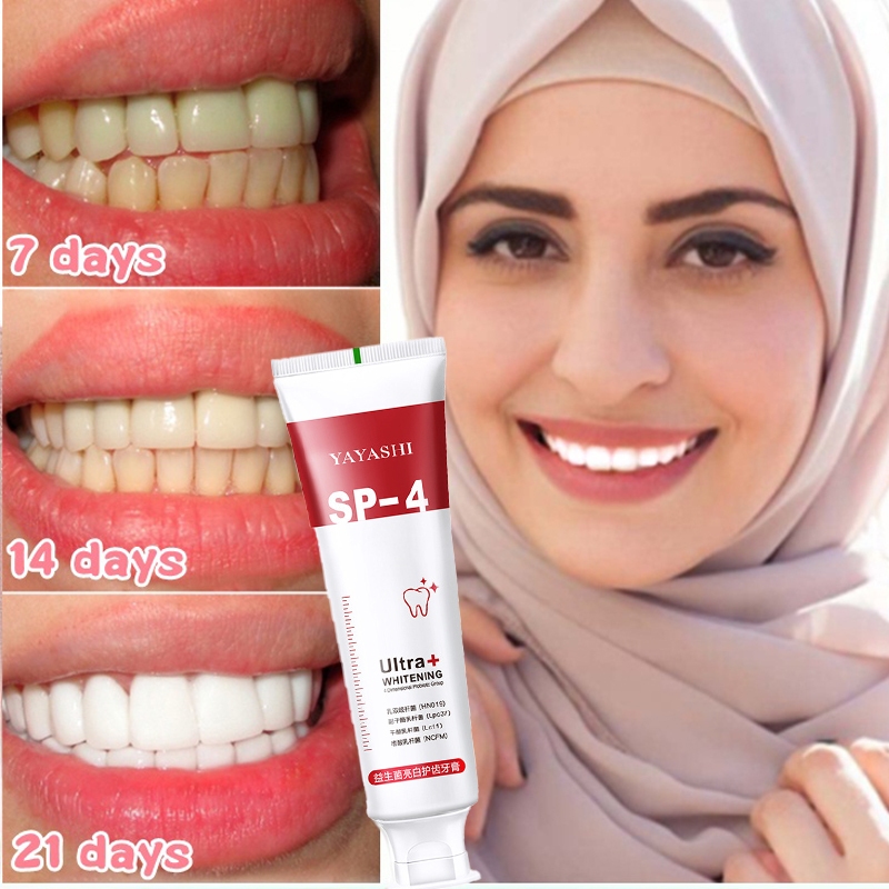 Toothpaste Whitening Toothpaste Remove Yellow Teeth Fresh Breath 120g ...