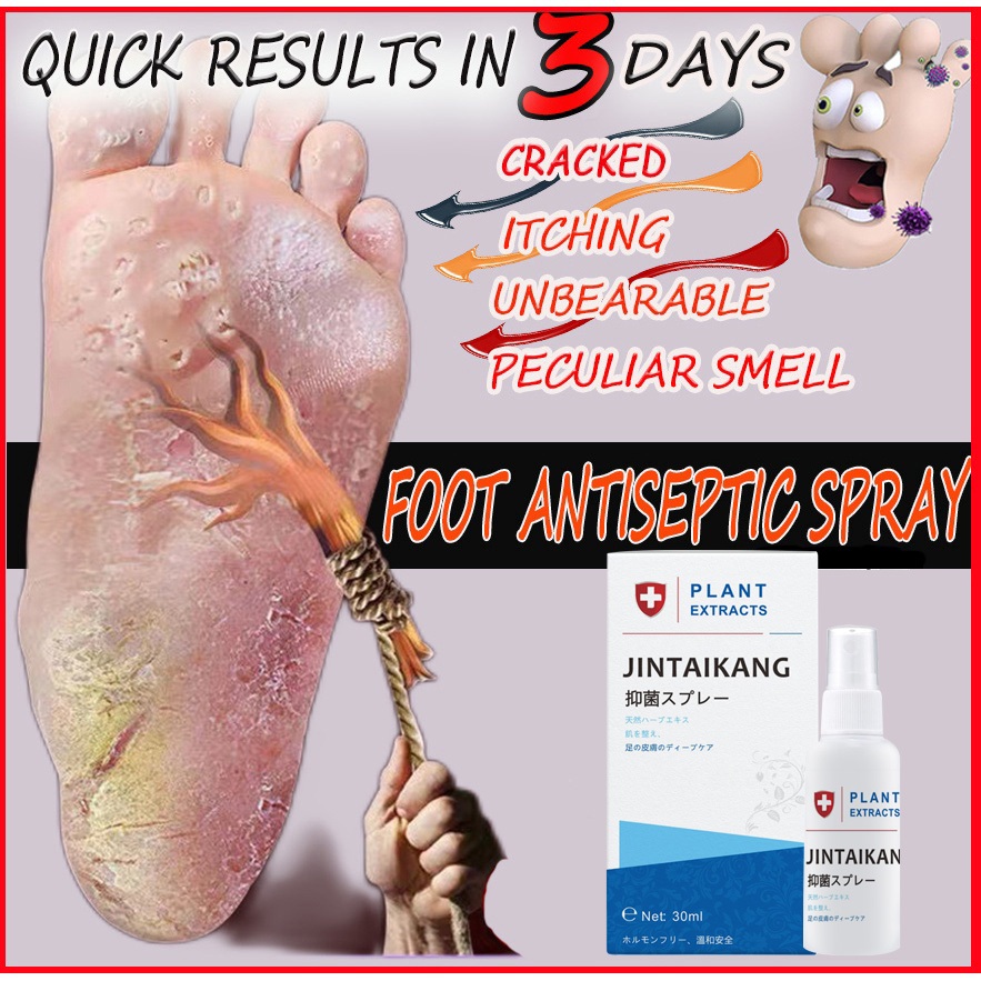 Foot Treatment Spray Anti fungal spray 30ml Herb Deodorant Anti Itch ...