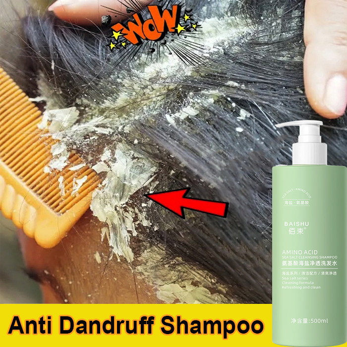 Dandruff Shampoo 500ml Treat Psoriasis Scalp Amino acid Anti-Dandruff Oil Control Nourish Hair ...
