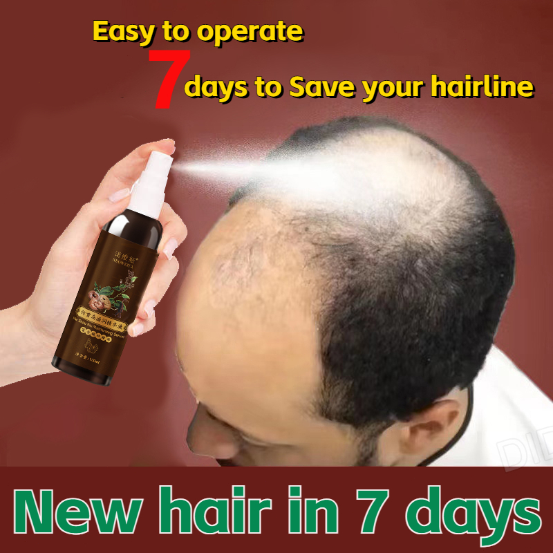 Hair Growth Serum Anti Hair Loss Tonic Hair Growth Spray 100ml Hair