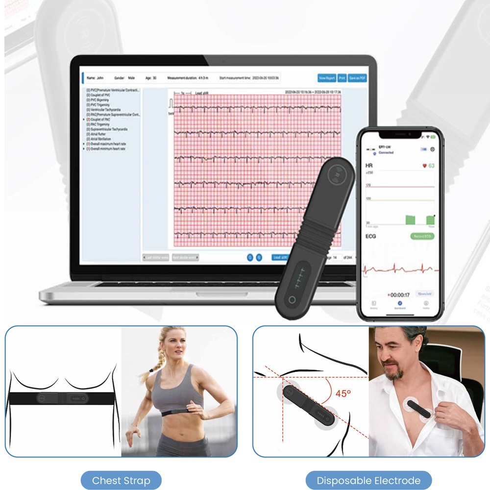 24 Hours Bluetooth Ai Holter Ecg Monitoring Wearable Ecg Ekg Rechargeable Monitor 17 Abnormal