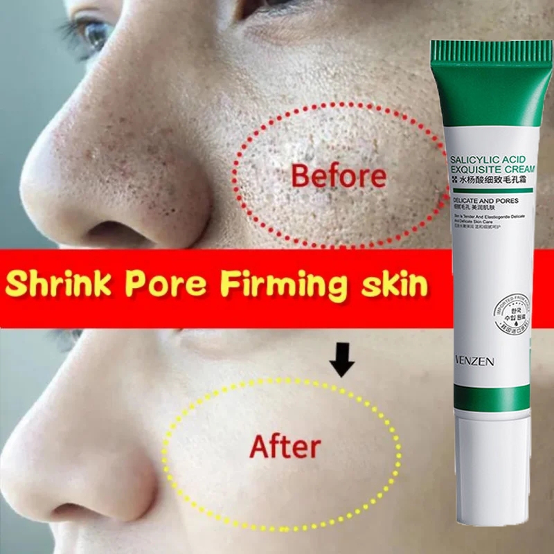 Salicylic Acid Pores Shrink Refining Cream Repair Large Open Pore ...