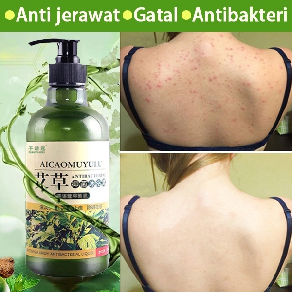 Acne Body Wash 500ml Herbal Wormwood Acne Clear Body Wash Anti Itch Removal Mite Body Care ...