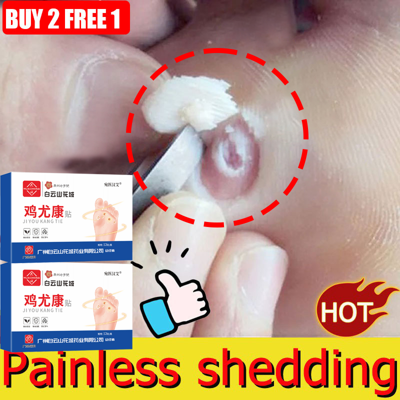 Wart Remover Pads/Corn Remover Wart And Skin Tag Removal Mole, Corn ...