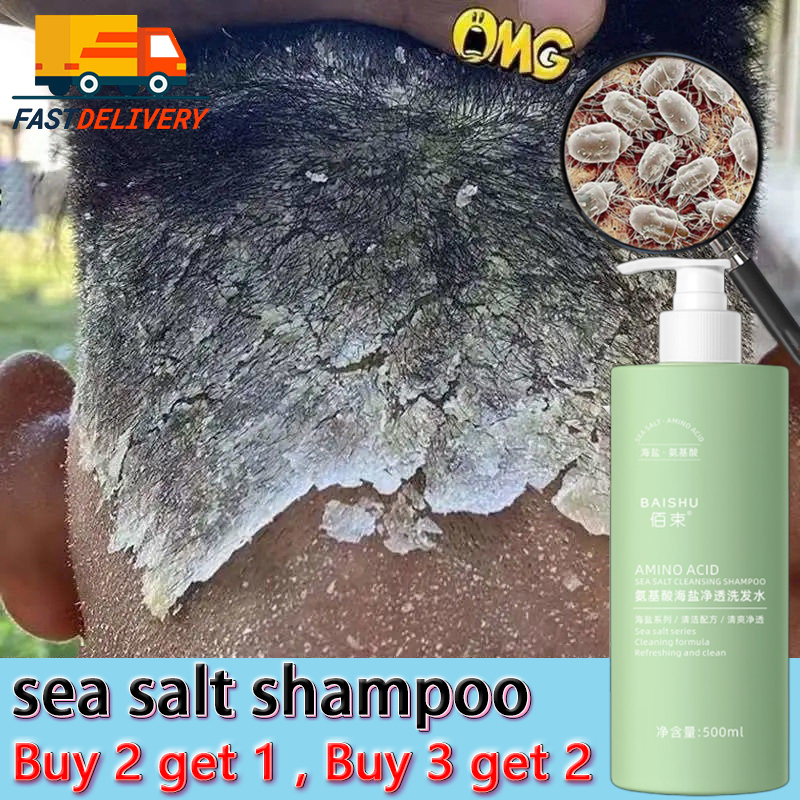 Dandruff medicine Anti dandruff shampoo Syampoo kelemumur dan gatal ...