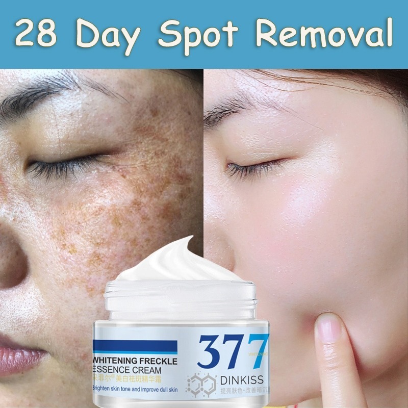 【100% Original】Whitening Freckle Remover Cream Dark Spot Remover 50g ...