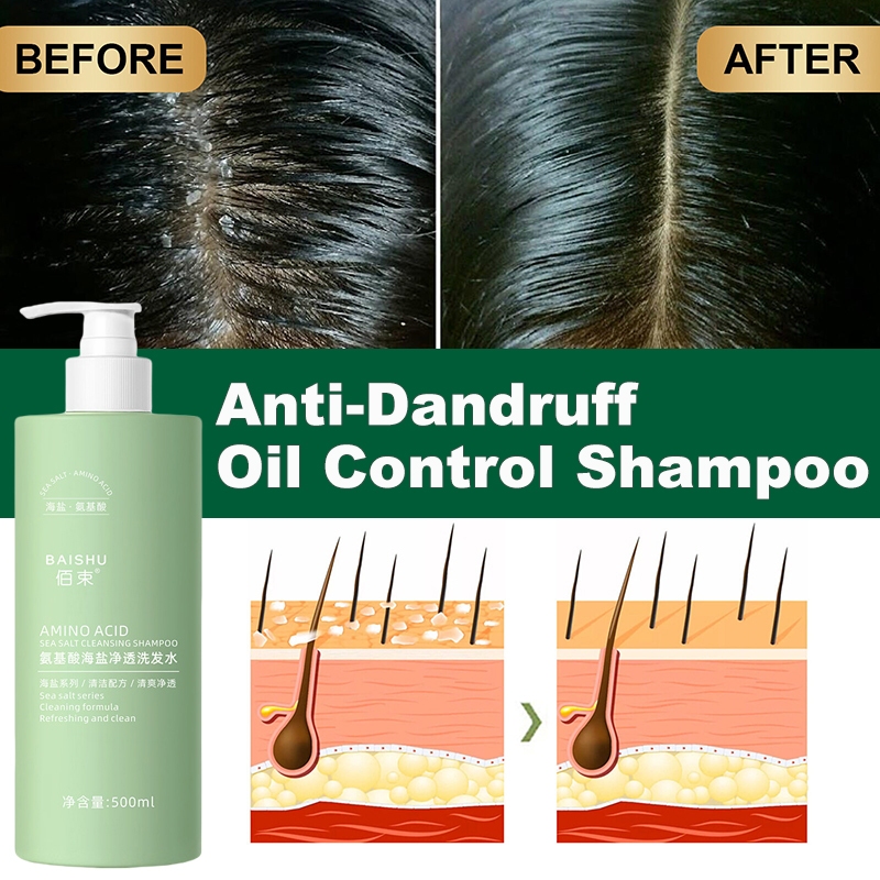 Dandruff shampoo Itchy scalp shampoo Oil control shampoo 500ml Amino acid anti-dandruff and oil ...