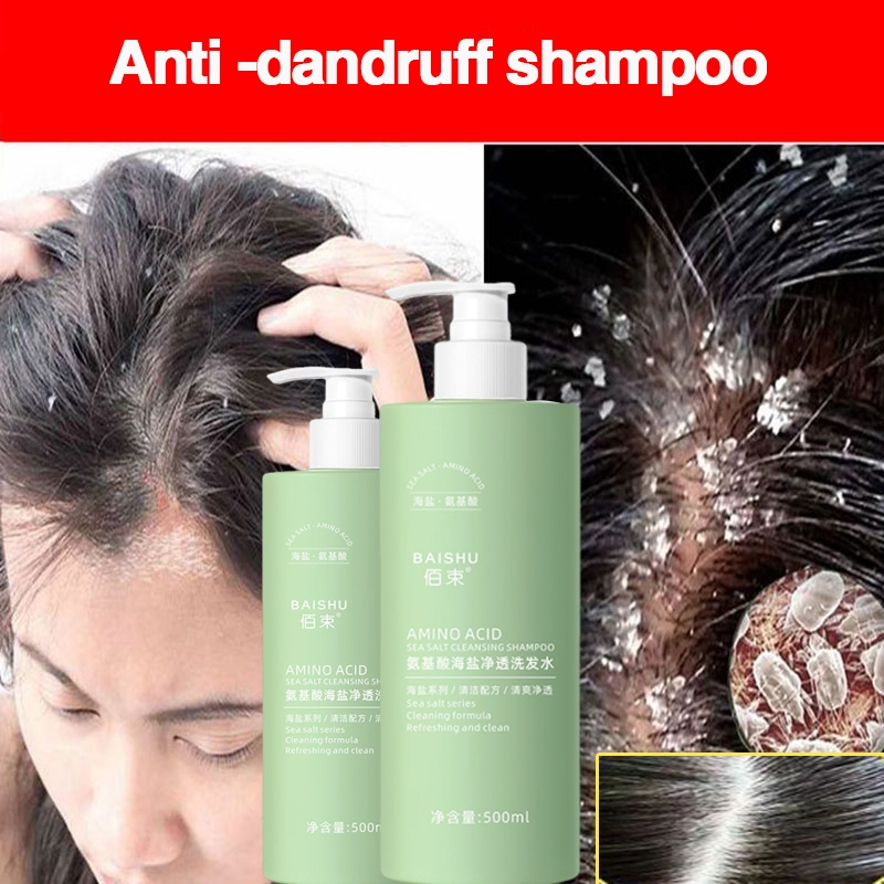 anti-dandruff shampoo Amino acid Scalp Treatment Shampoo 500ml itchy scalp hair care Anti Hair ...