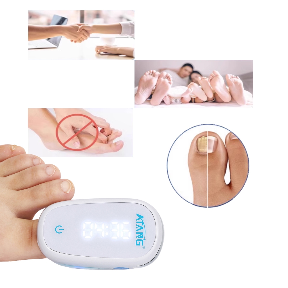 Infrared Light Therapy Nail Fungal Treatment Toenail Onychomycosis Nail ...