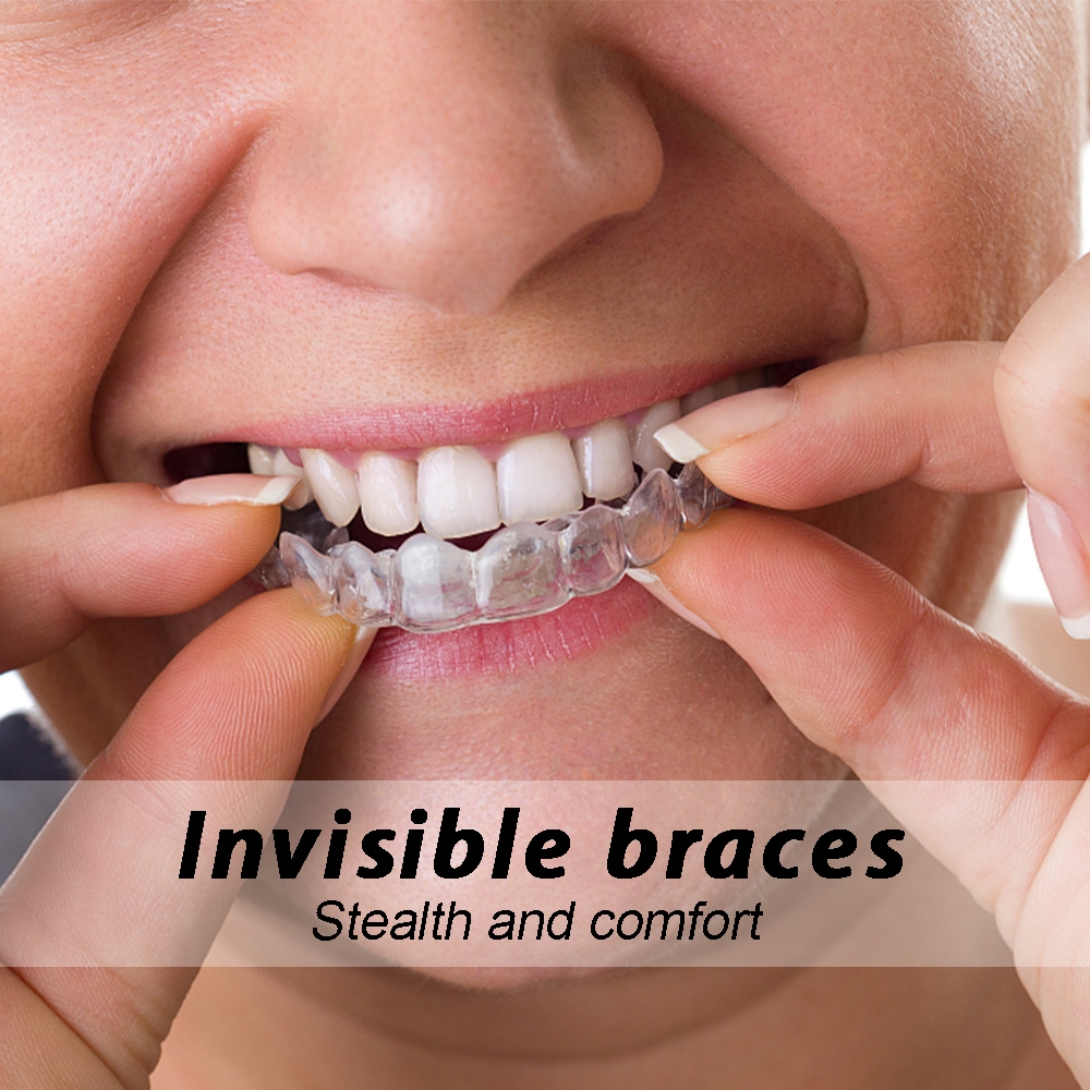 [Featured Recommendation]Invisible Braces Corrector Orthodontic ...