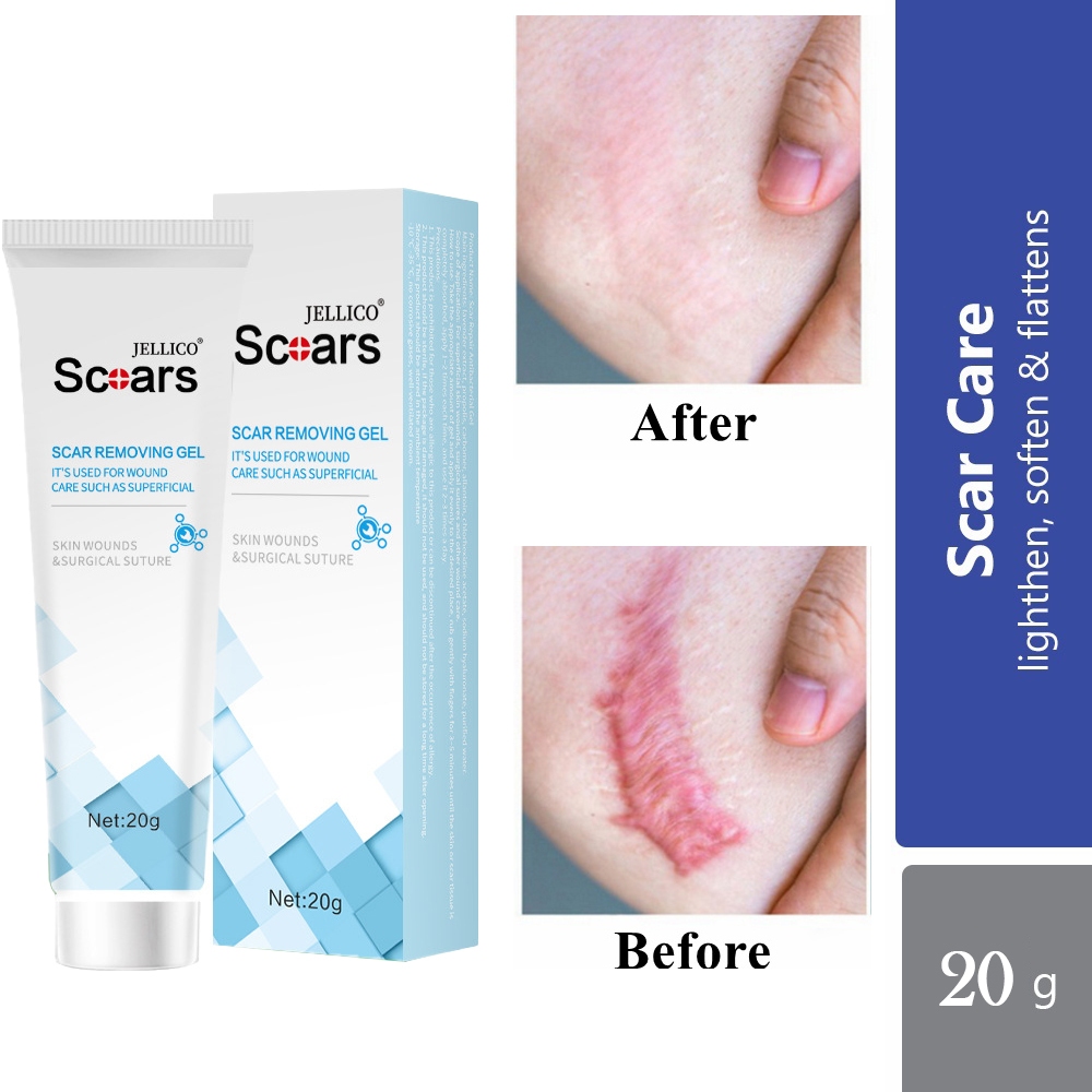Effective Scar Removal Gel Cream Old Scar Remover Acne Treatment 15g ...