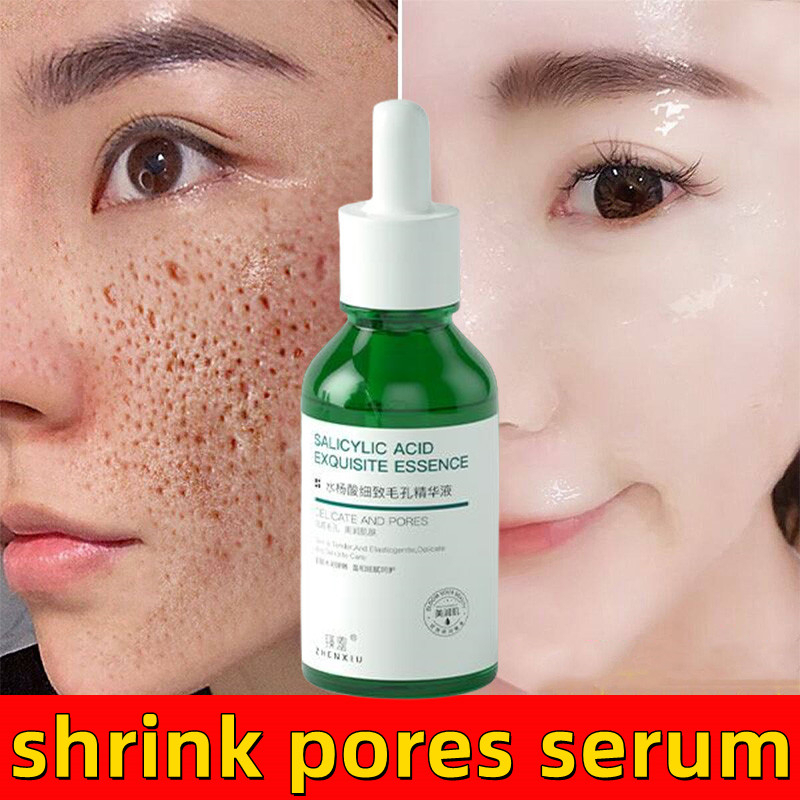 Pore essence lighten pigmentation remove acne marks refine pores ...