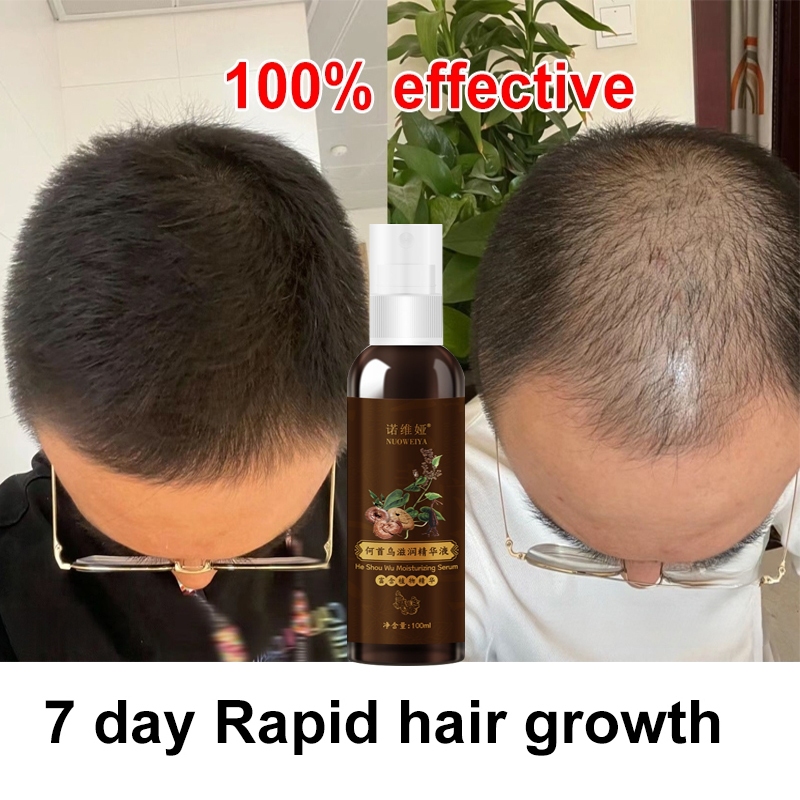 Hair growth serum Hair serum Hair tonic hair growth spray 100ml Plant ...