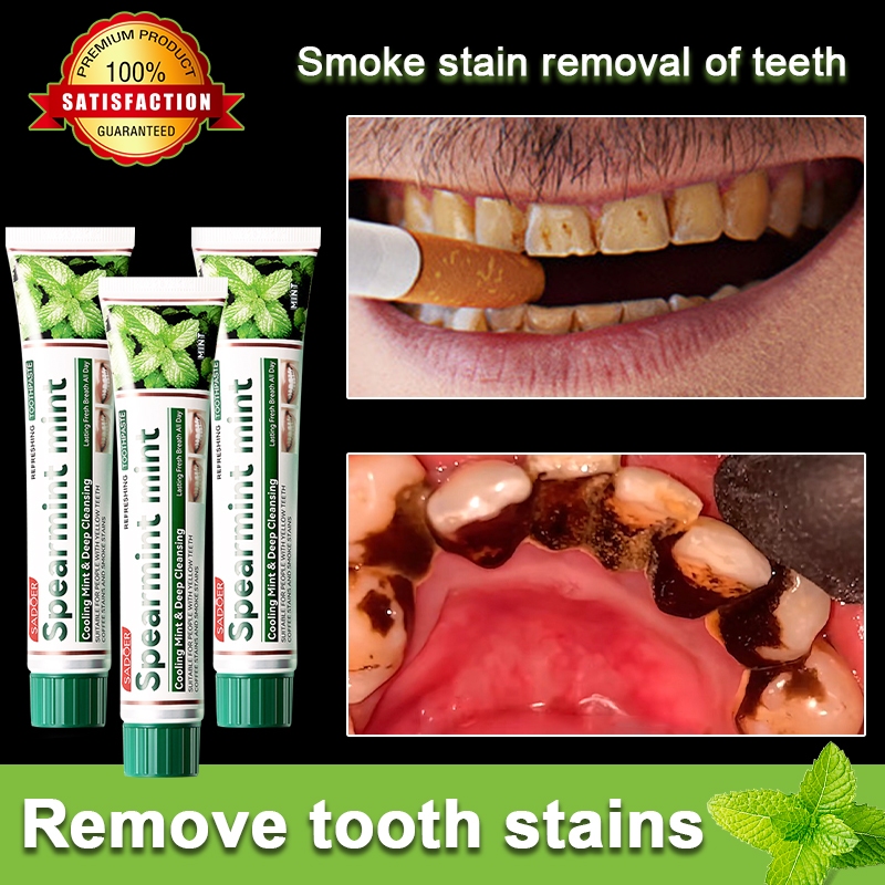 Whitening teeth refreshing mint antibacterial whitening toothpaste 100g ...