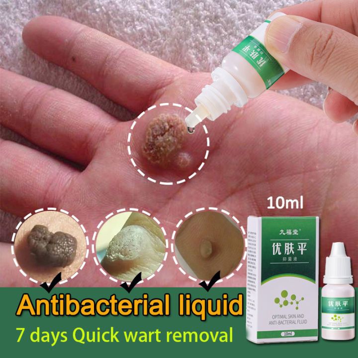 Skin Tag Remover Warts Removal Cream Mole Remover Genital Warts Foot