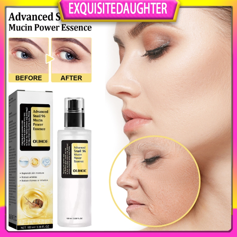 【COD】OUHOE Snail 96 Collagen Power essence Repairs Skin Barrier, Moisturizes and Lightens Black ...