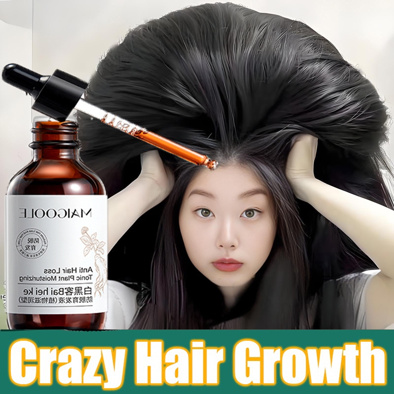 【fast Effective 】hair Growth Serum Ginger Hair Tonic 30ml Hair Growth
