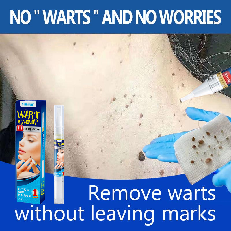 Wart Removal Pen Mole Remover skin tag remover Dark Spot Remover Non ...
