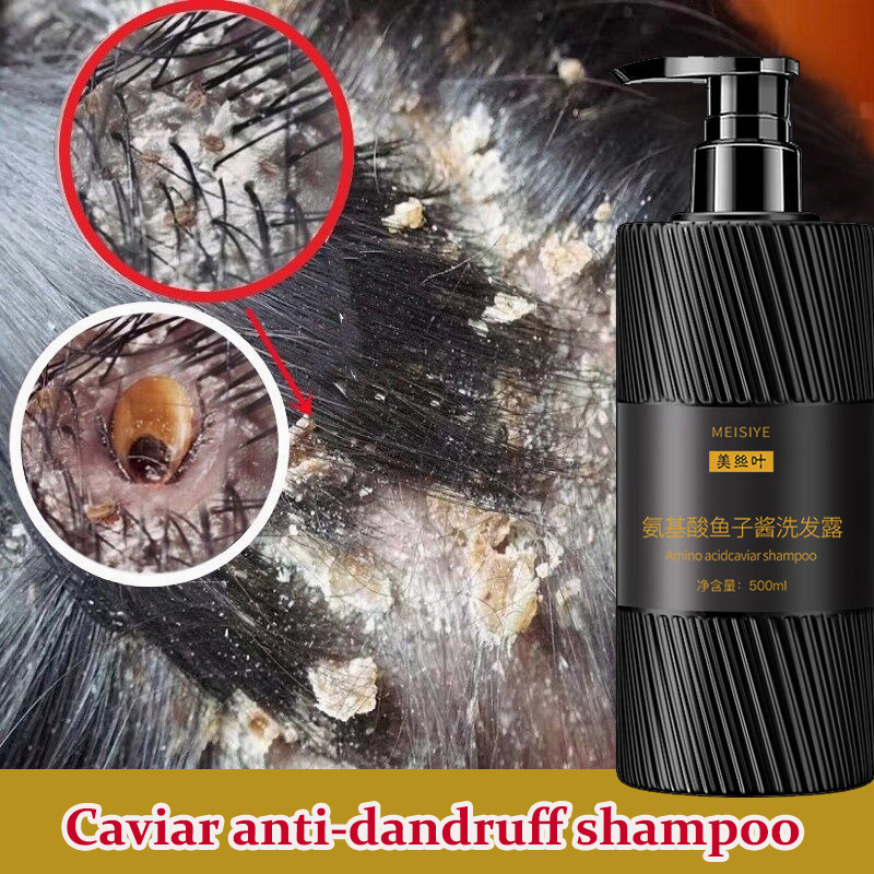 ⚡Caviar Anti Dandruff Shampoo⚡Scalp Seborrheic Dermatitis Remove ...