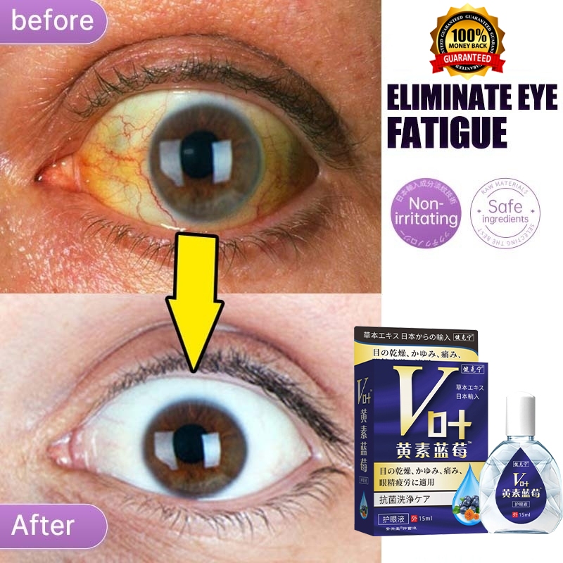 Blueberry Lutein Eye Brightening Liquid Eye improve blurred vision ...
