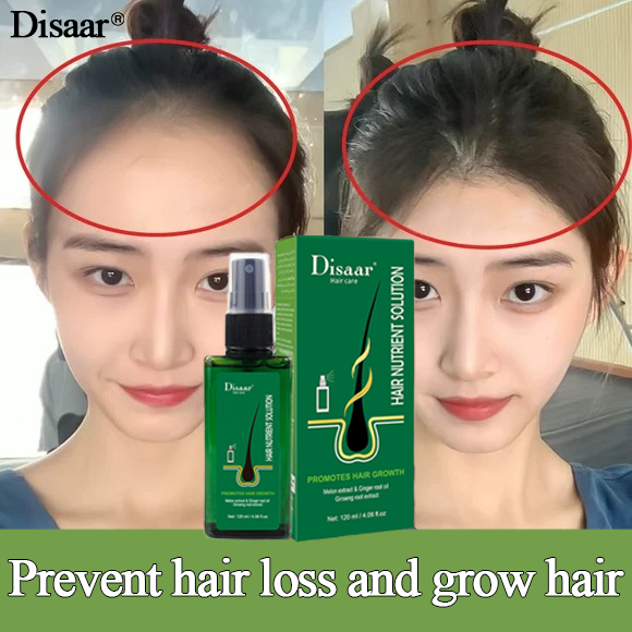 【Rapid hair growth】Disaar Hair growth spray, 120ml, Hair Growth Serum ... 【Rapid hair growth】Disaar Hair growth spray, 120ml, Hair Growth Serum ...