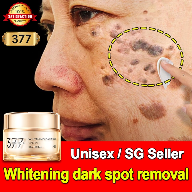 377 美白淡斑面霜 Dark Spot Remover Melasma Cream removal 30g remove sun spots ...