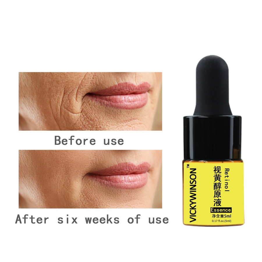 Retinol essence 5ml anti wrinkle essence A alcohol anti wrinkle, fade ...