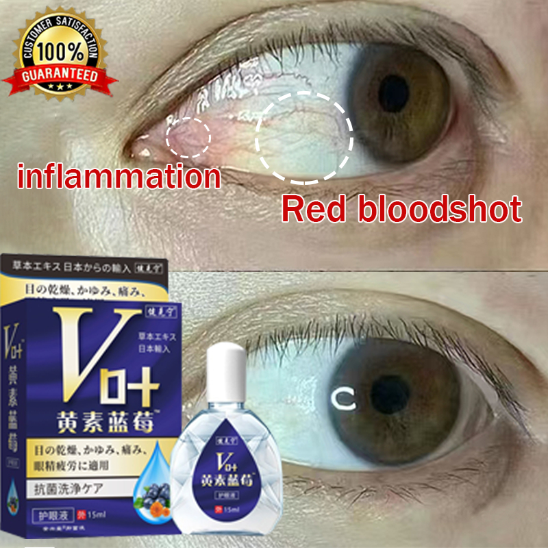 Eye drop dry eyes Anti-Fatigue Eye Drops 15ml Itchy Eye Care Eyesight ...