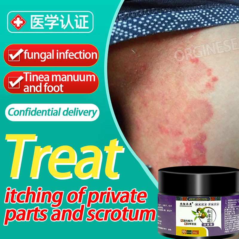 Private part itching cream itchy cream for skin jock itch antifungal ...